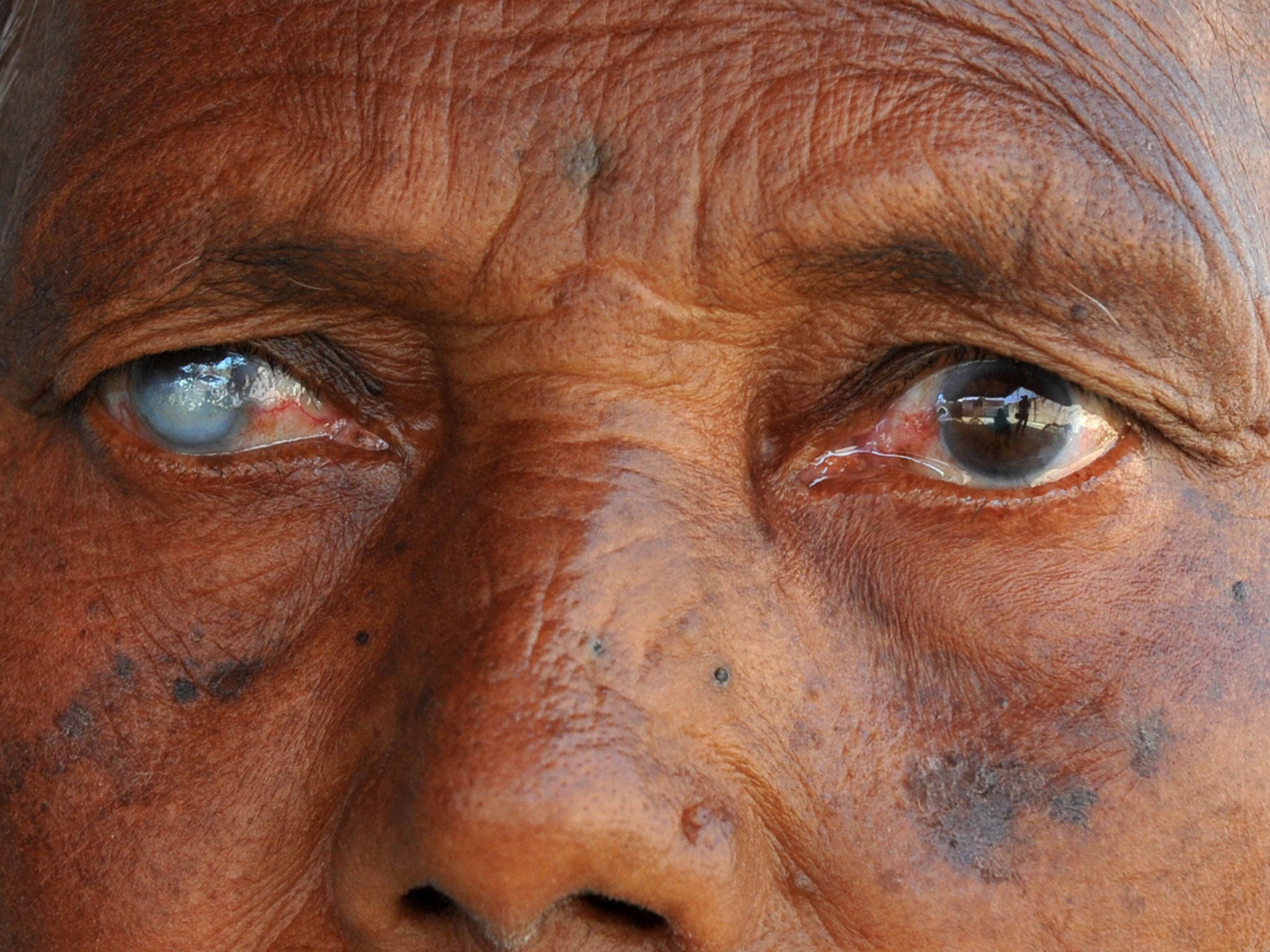 Procedure To Restore Sight In Dogs Gives Hope For Future Blindness Cure 