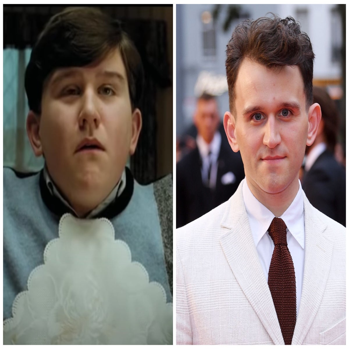 harry melling weight