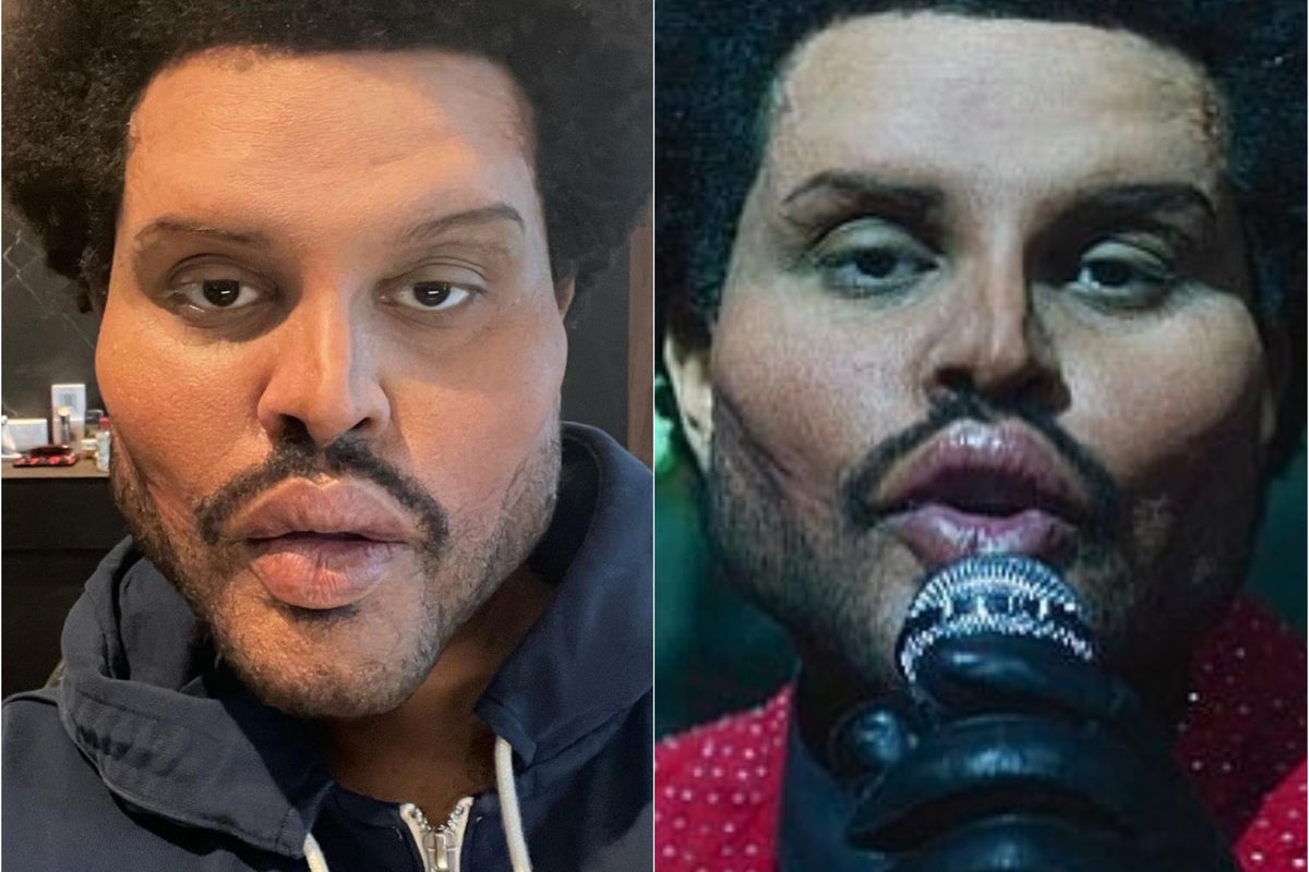What happened to The Weeknd’s face? Singer removes bandages to reveal ...