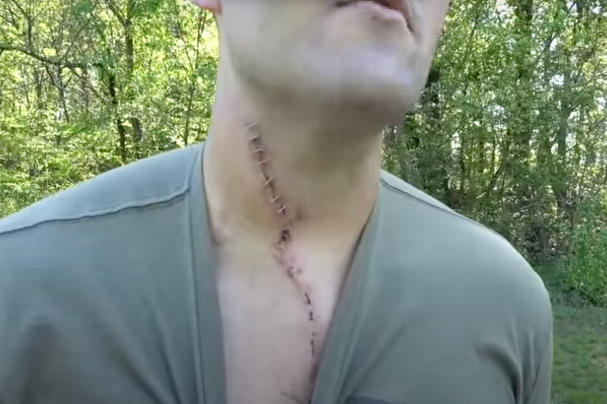 YouTube weapons expert left with horror injuries after gun exploded in ...