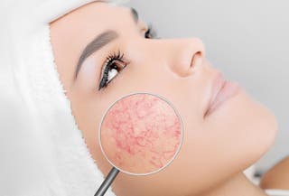 When you should be worried about flushed skin: Experts highlight signs ...