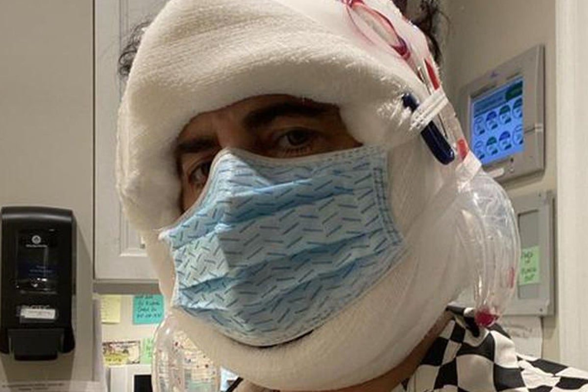 Marc Jacobs shares bandaged photo of himself after facelift | The ...