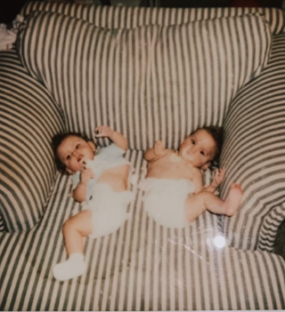 I was a conjoined twin - complications killed my sister at 13. This is ...