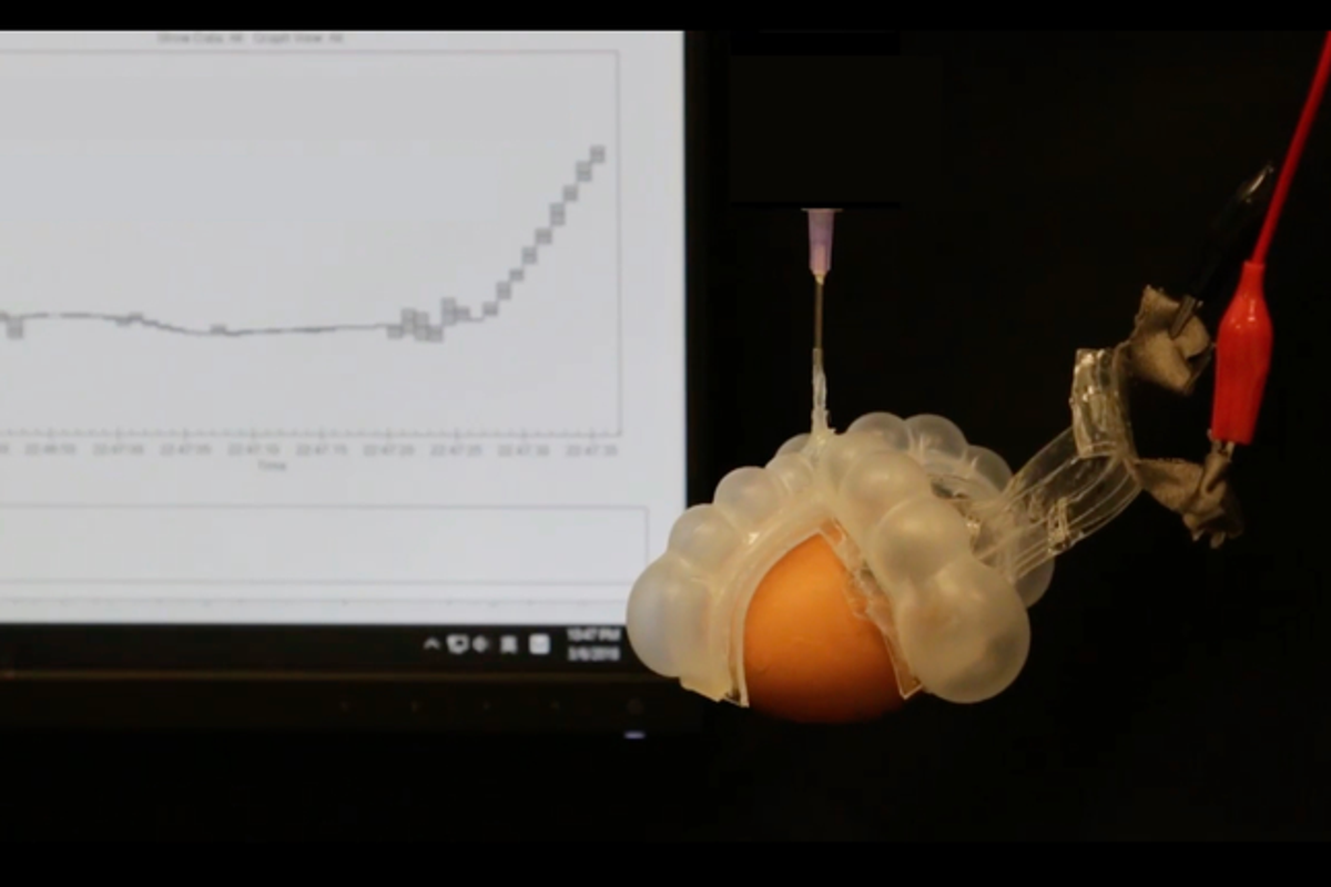 Scientists build stretchable thermometer that could lead to next-gen ...