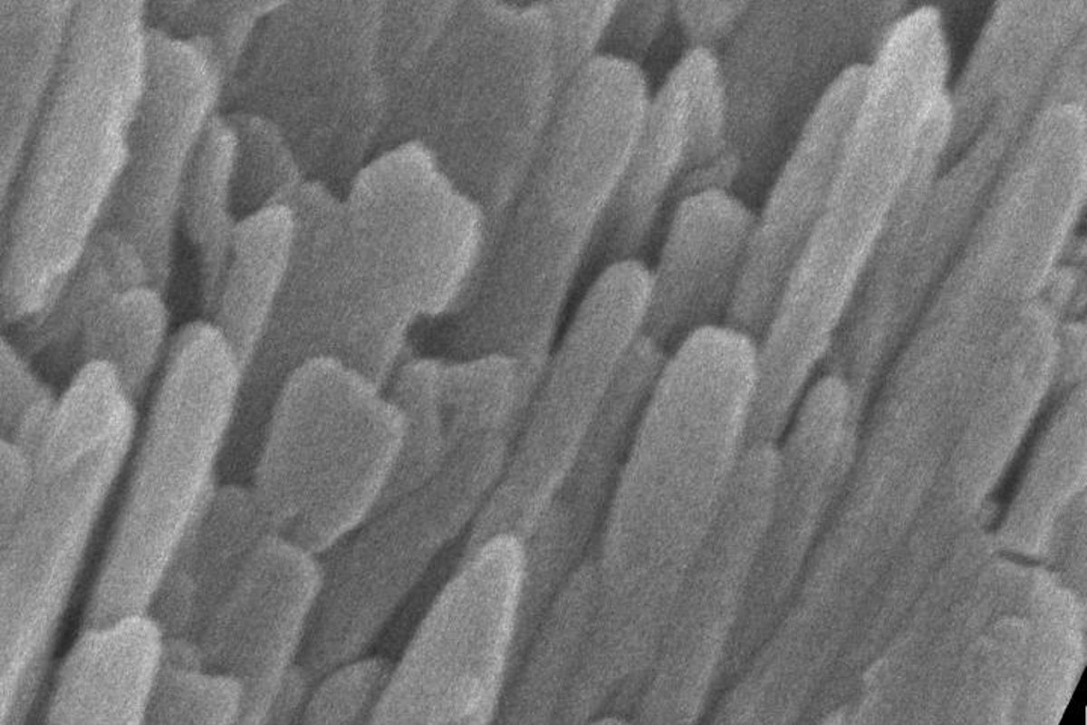 Scientists develop synthetic enamel that’s stronger than natural tooth ...