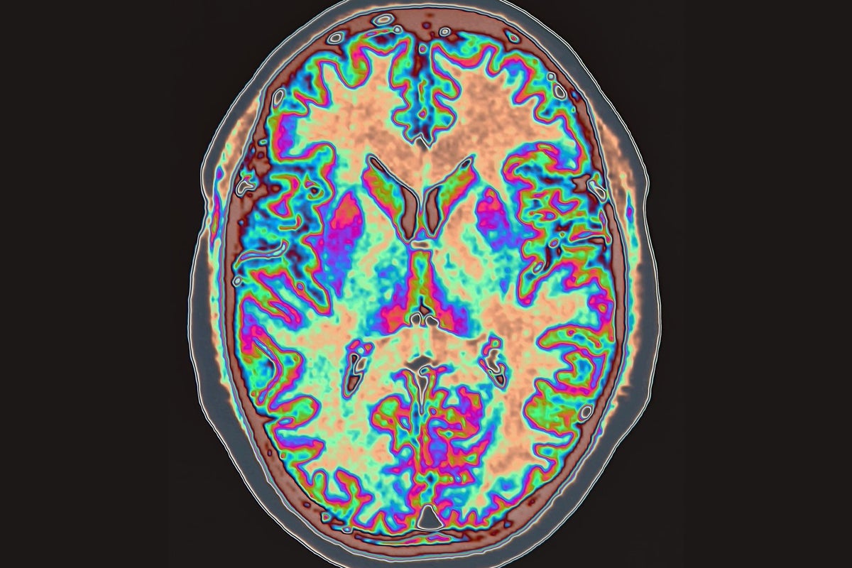 Scientists read brain waves to see what people picture in their mind’s ...