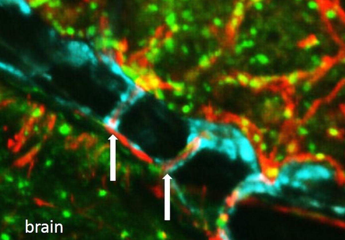 Study finds tiny channels in skull that could play ‘vital role’ in ...