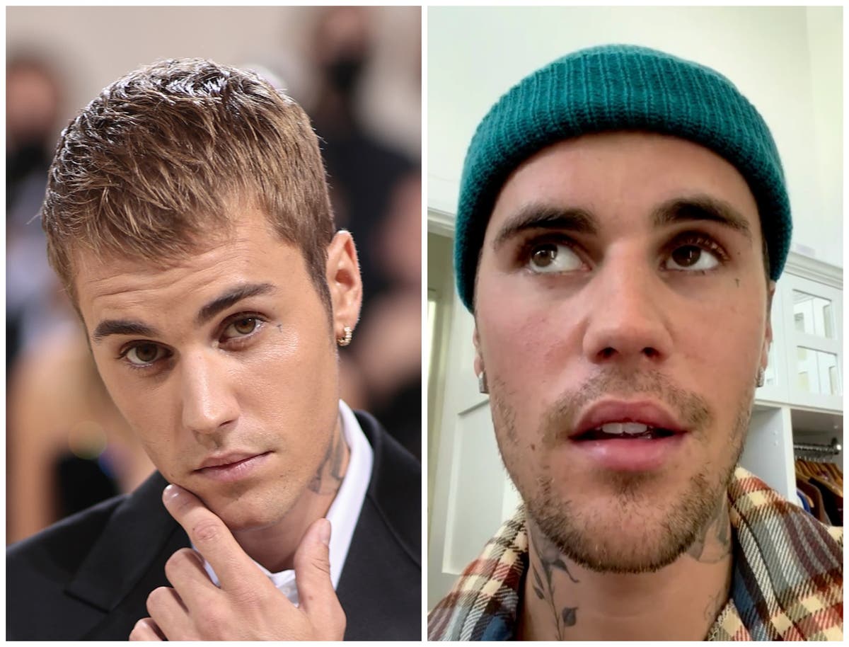 Justin Bieber’s diagnosis: I’m a facial paralysis doctor – let me tell ...