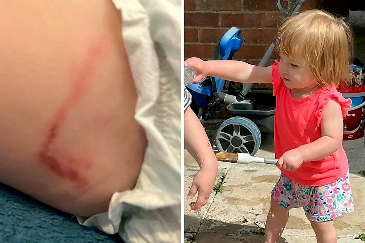 Extreme heat: Mother’s horror as toddler suffers burn from tricycle as ...