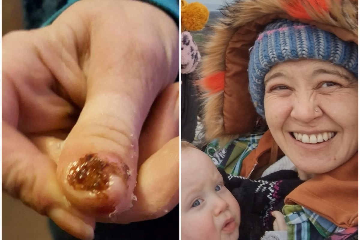 Woman with ‘rotting skin’ credits birthing twins to discovering mystery ...