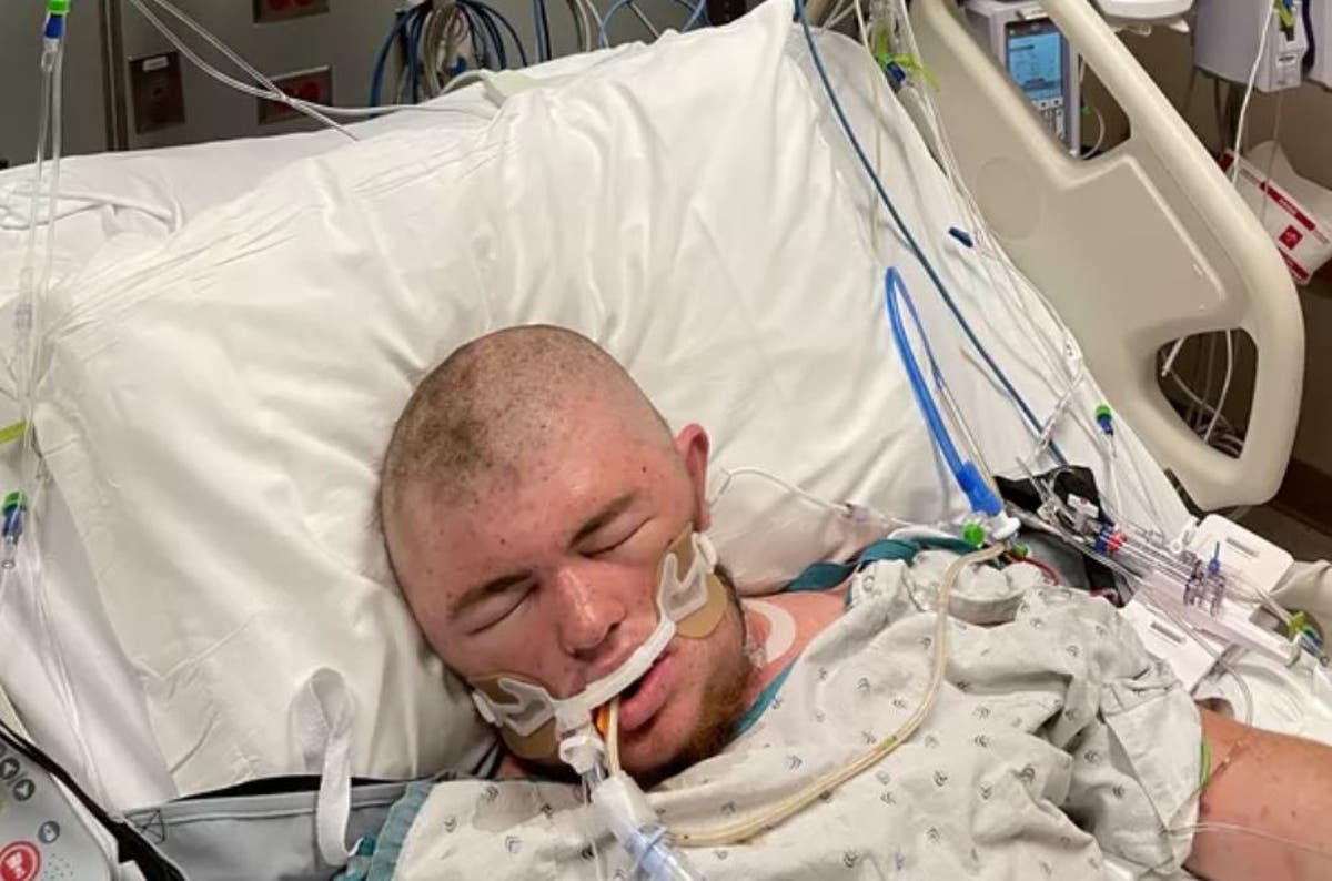 Ohio man, 20, on life support after being stung by bees thousands of ...