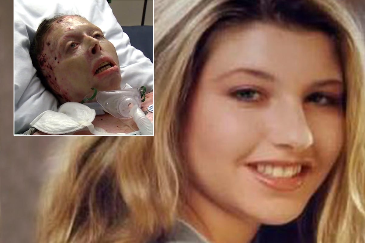 She was burnt alive by the man she loved. Then Judy Malinowski ...