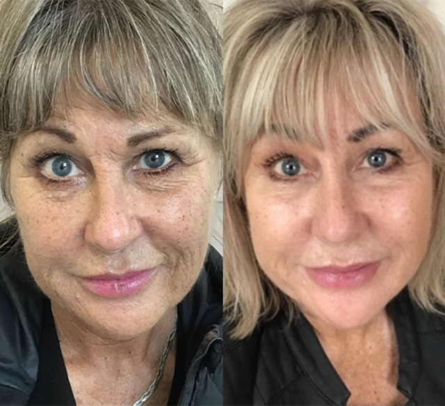 Upgrade to Dermatica’s affordable personalised skincare for your best ...