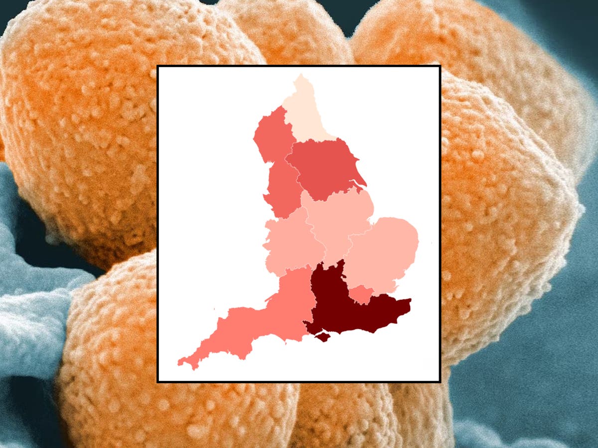 How do you catch Strep A? Number of cases in your area as infections ...