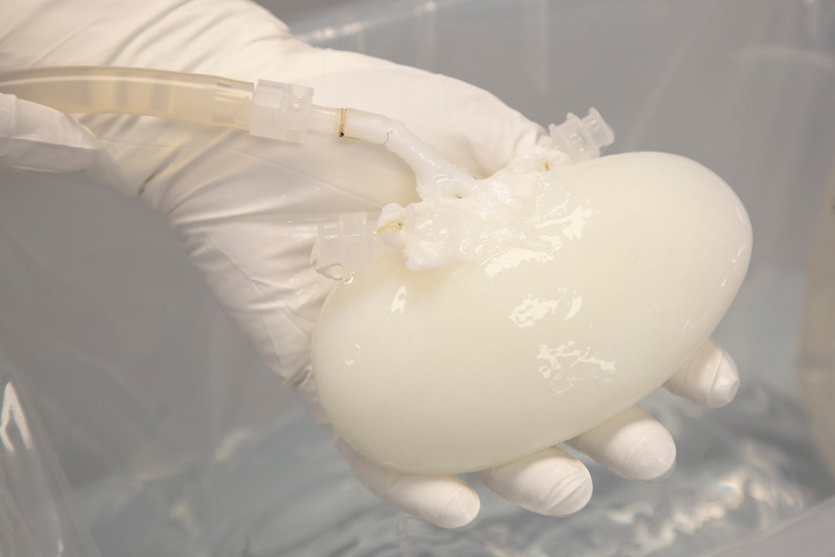 Making pig livers humanlike in quest to ease organ shortage | The ...