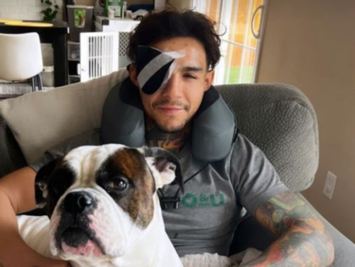 ufc-fighter-andre-fili-out-of-bout-after-emergency-eye-surgical-procedure
