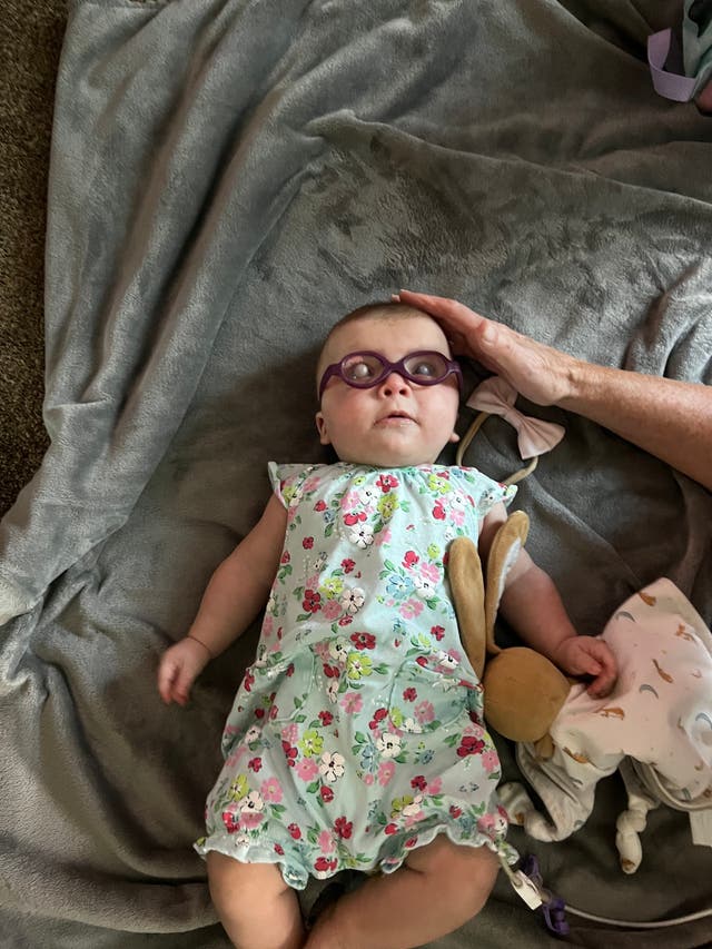Mother documents story of baby born with bubble on eyeball from ...