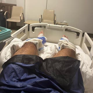 Turkey leg lengthening surgery: Georgia man has £86,000 surgery to make ...