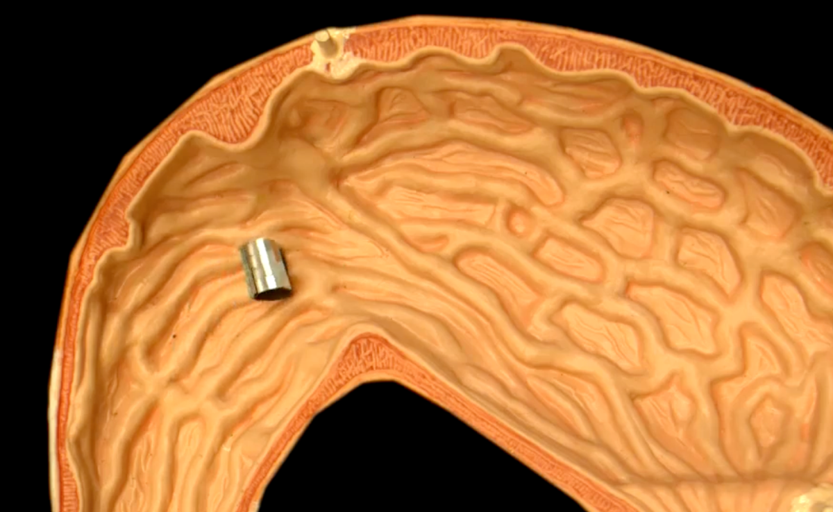 Scientists create tiny robot that works like an animal and swims around ...