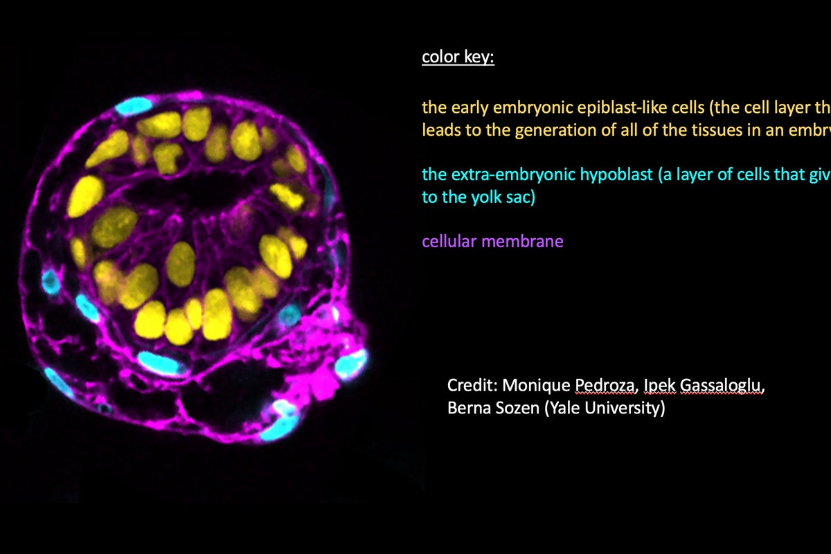 Scientists use stem cells to create models of human embryos and study ...
