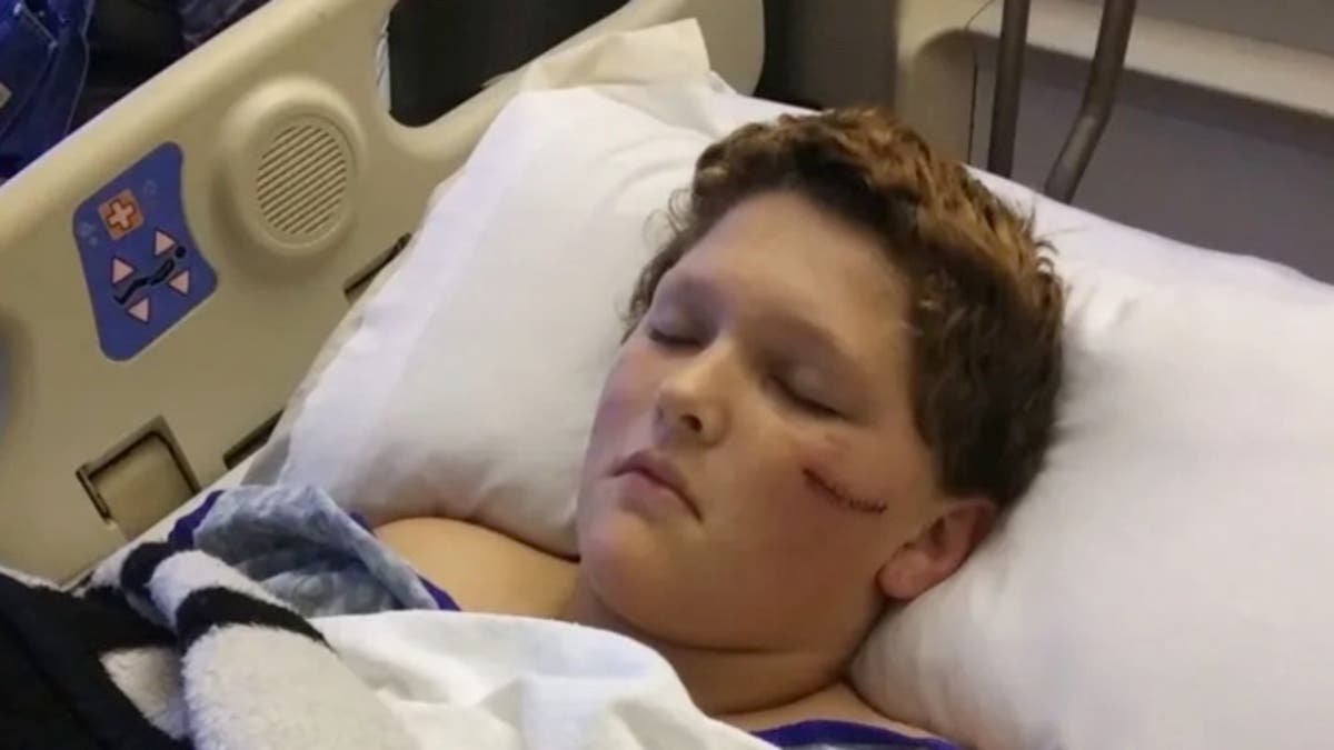 North Carolina boy, 12, attacked by pack of dogs: 'They were eating him' | The Independent