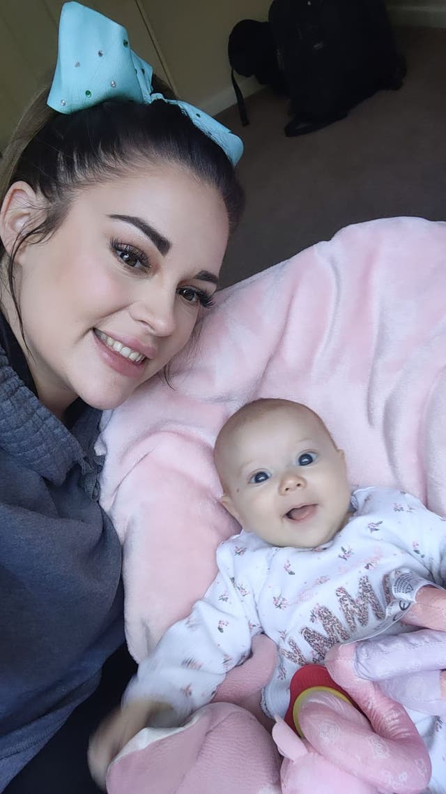 Bilateral congenital glaucoma: My baby’s beautiful blue eyes turned out ...