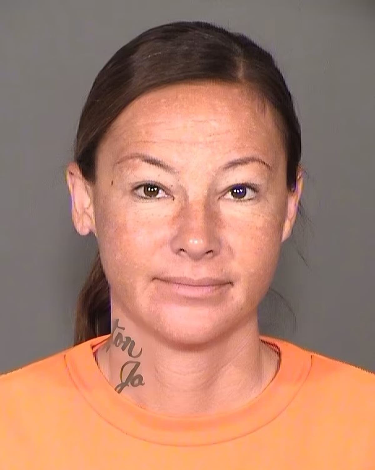 Arizona inmate suffers horrific injuries after technician does not ...