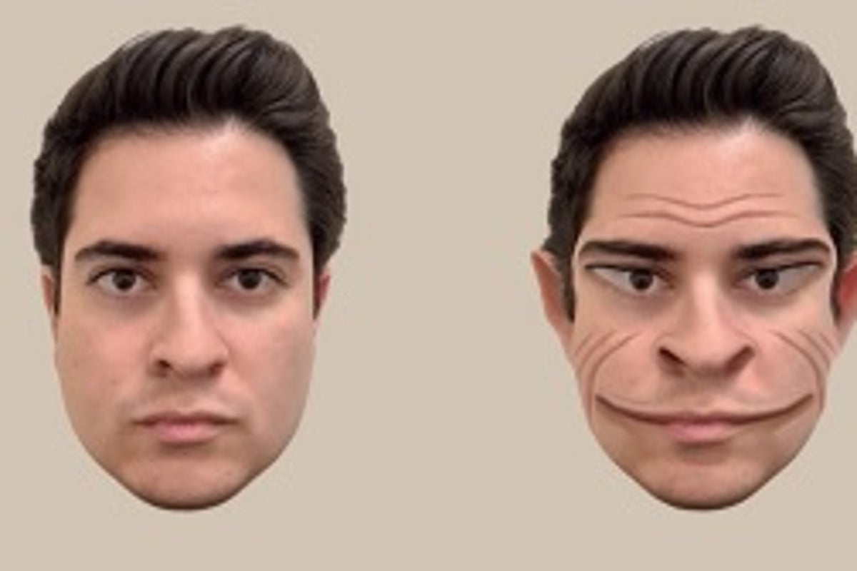 Demon face disorder: Images show how people with rare neurological ...