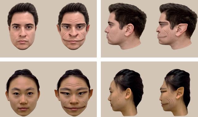 Demon face disorder: Images show how people with rare neurological ...