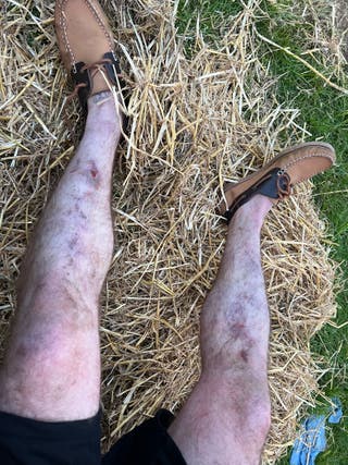 Man who won shin kicking world title on first try defends crown | The ...