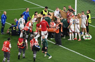 Hungary striker suffers broken bones in face after horror collision ...
