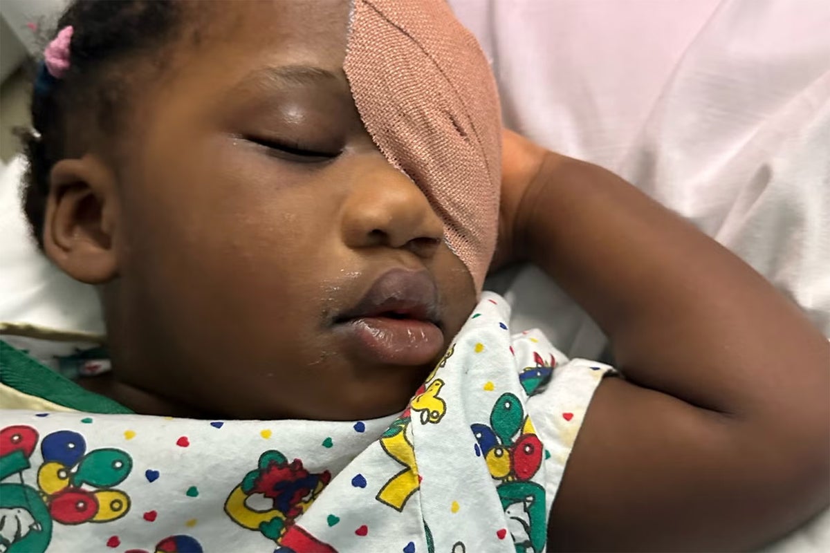 Father’s shock after baby’s ‘sparkly and golden’ eye turned out to be ...