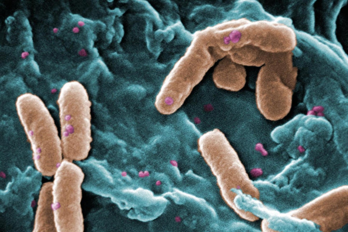 pseudomonas putida superbug