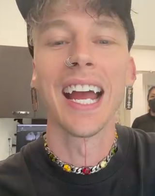 Machine Gun Kelly debuts new fang teeth in dentist’s office | The ...