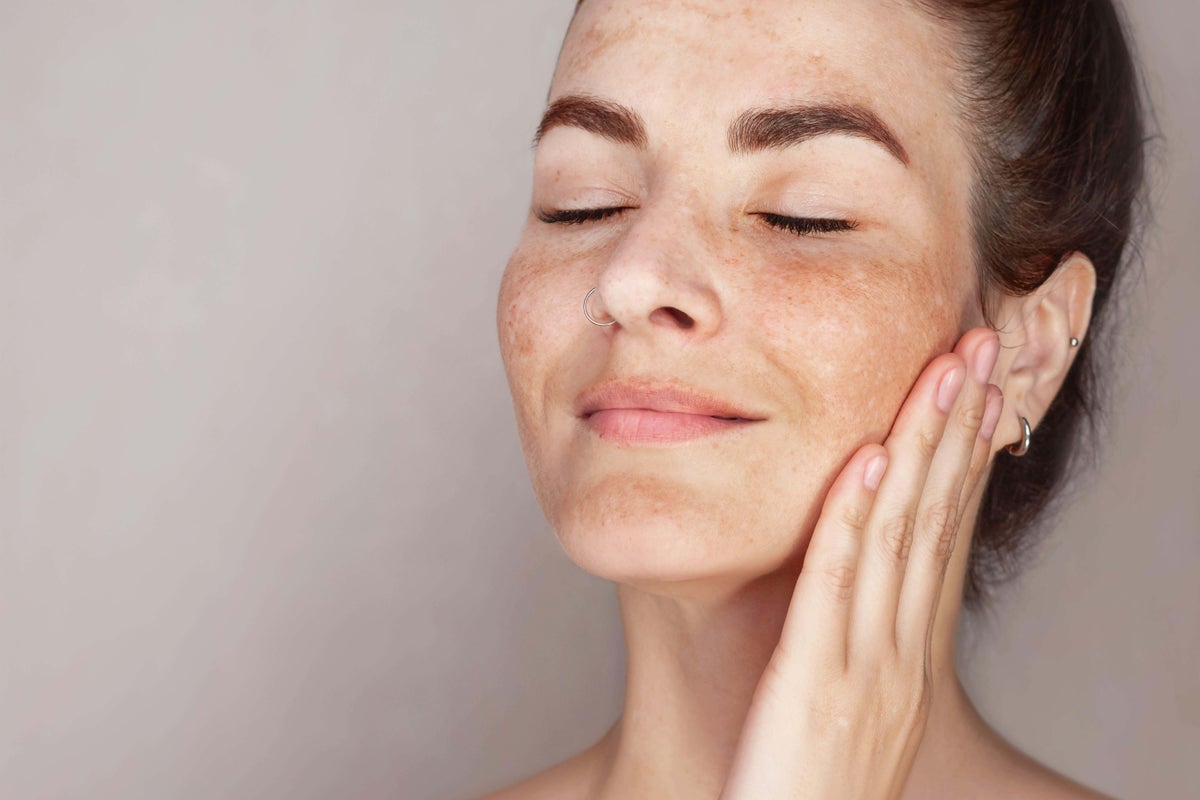 Why the sun gives you hyperpigmentation and what you can do about it ...