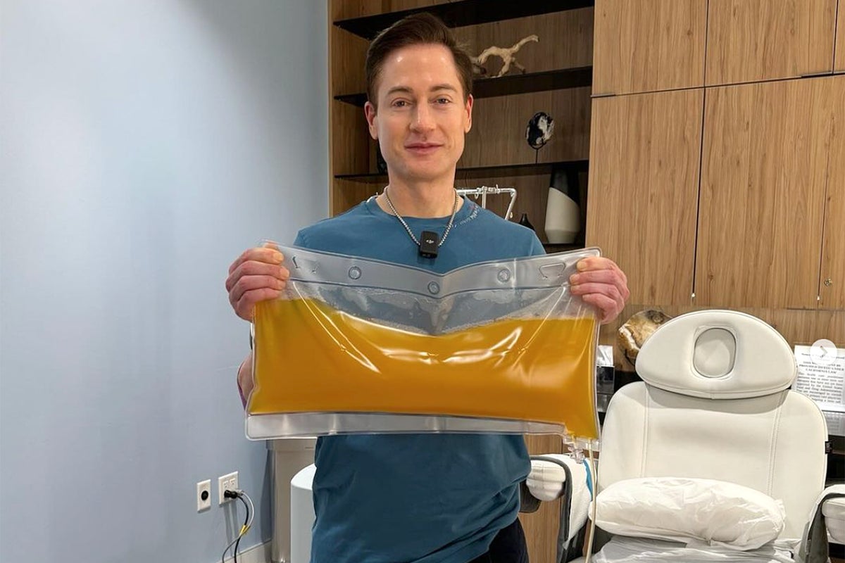 Bryan Johnson: Multimillionaire biohacker replaces the ‘liquid gold’ in ...