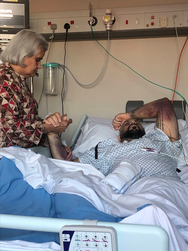 Man ‘cheats death’ with quintuple heart bypass after extremely rare ...