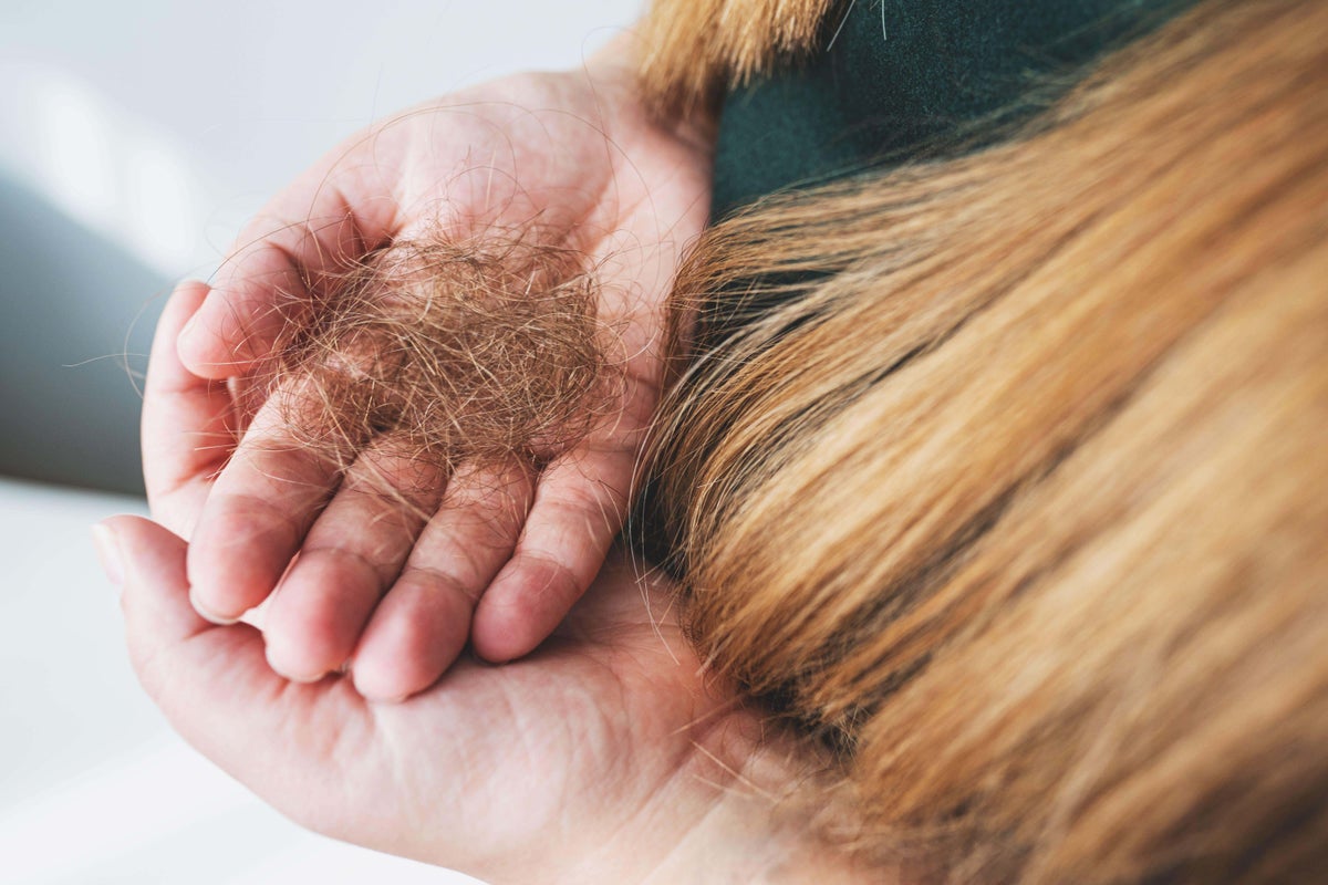 Why winter hair loss happens and how can you stop it | The Independent