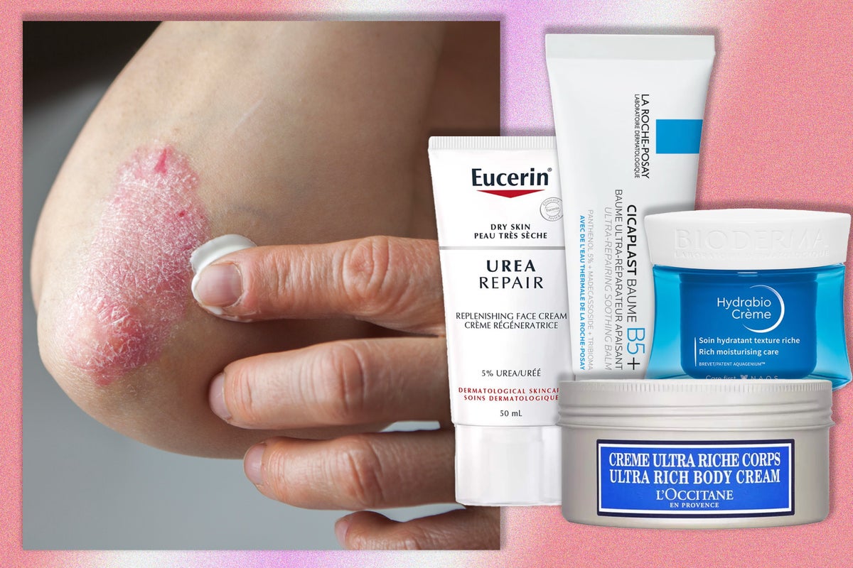 Best Creams For Psoriasis 2025 Recommended By A Dermatologist The Independent