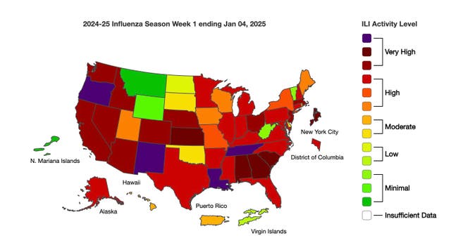 Where is the flu surging across the US? Hospitals restrict access as ...