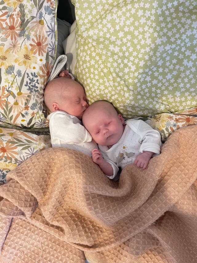 Bilateral anophthalmia: Baby born without eyes due to extremely rare ...