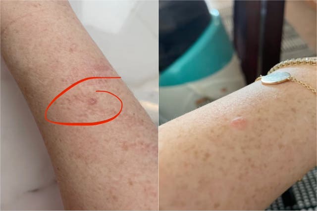 Katherine Ryan clears up misconception around second cancer diagnosis ...