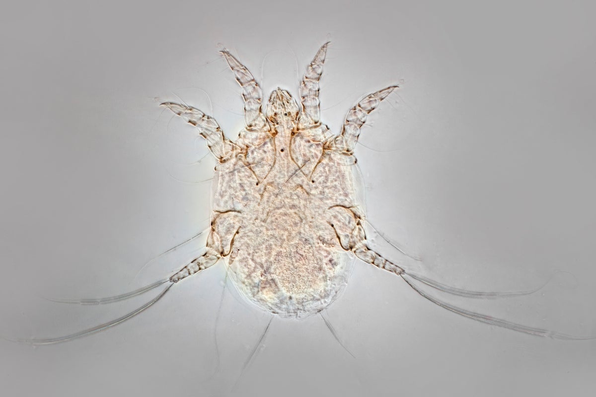 How to spot, treat and prevent scabies, according to the experts | The ...