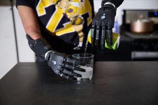 World’s most advanced bionic arm can crawl around on its own | The ...