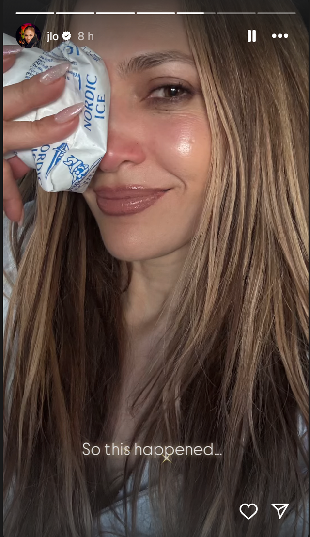 Jennifer Lopez reveals facial injury from American Music Awards ...