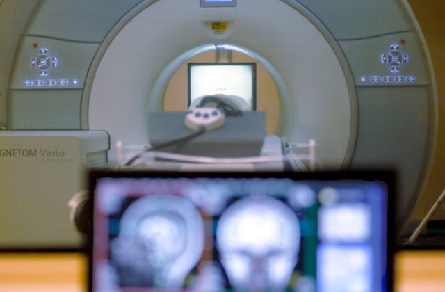 Woman having MRI scan describes horrifying moment her husband was ...