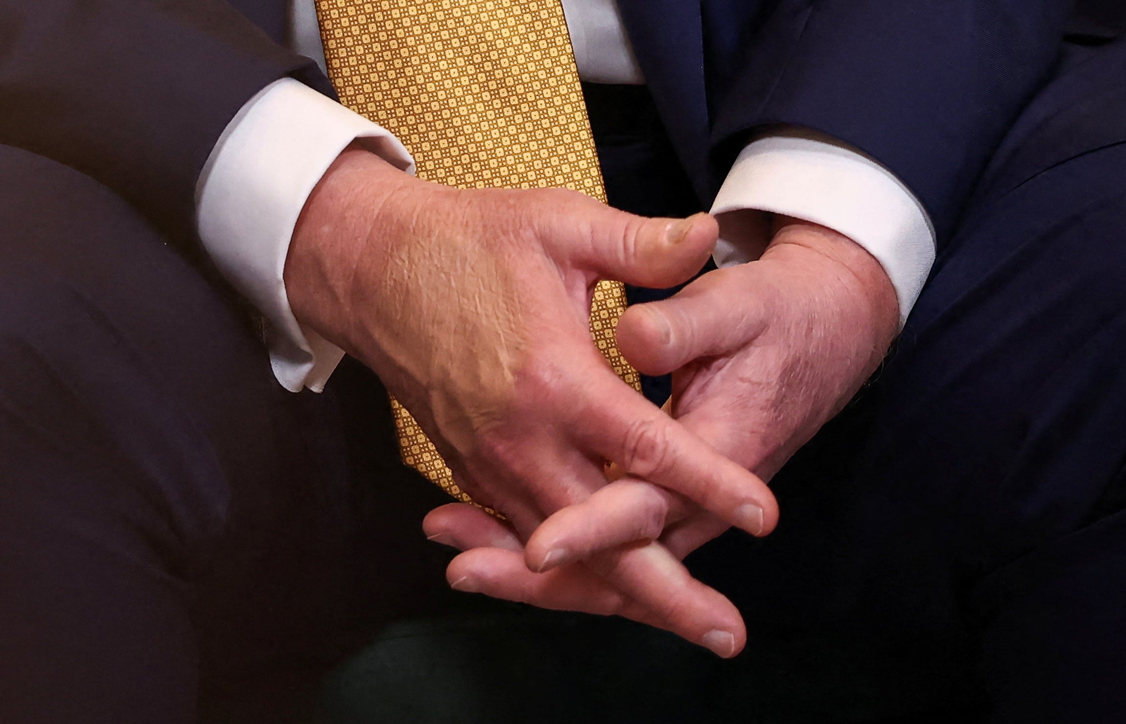 Trump’s hand makeup is back during Scotland trip as he deals with ...