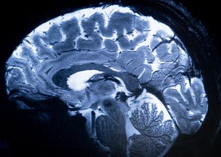 Scientists make ‘striking’ discovery about what mental health ...