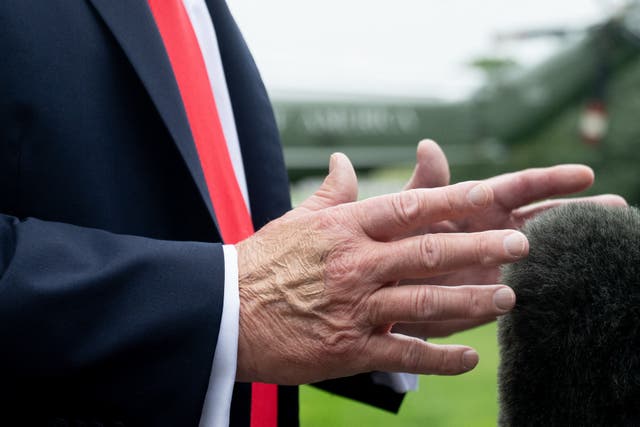 White House puts out new picture showing Donald Trump’s makeup-covered ...