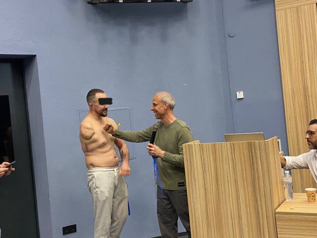 Botox injections could help pain relief for Ukrainian war amputees ...